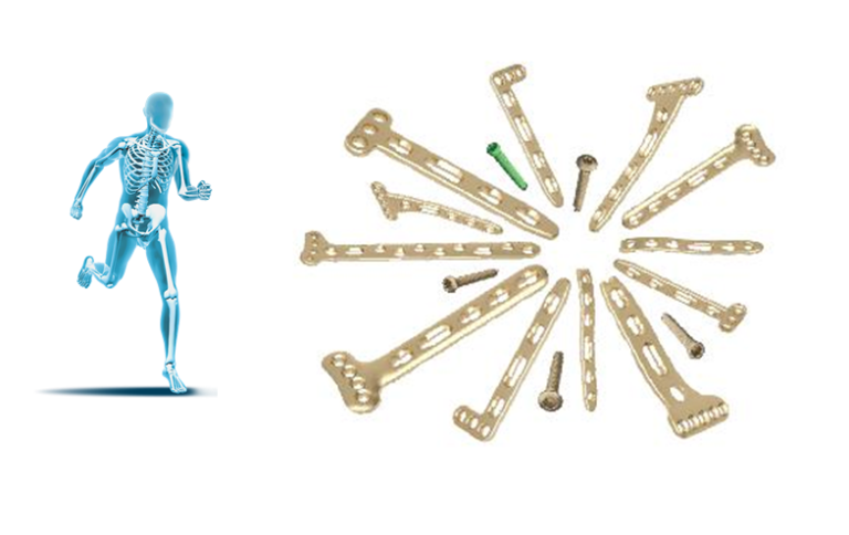 2.4mm Meril Locking Distal Radial System – Orthoprimed